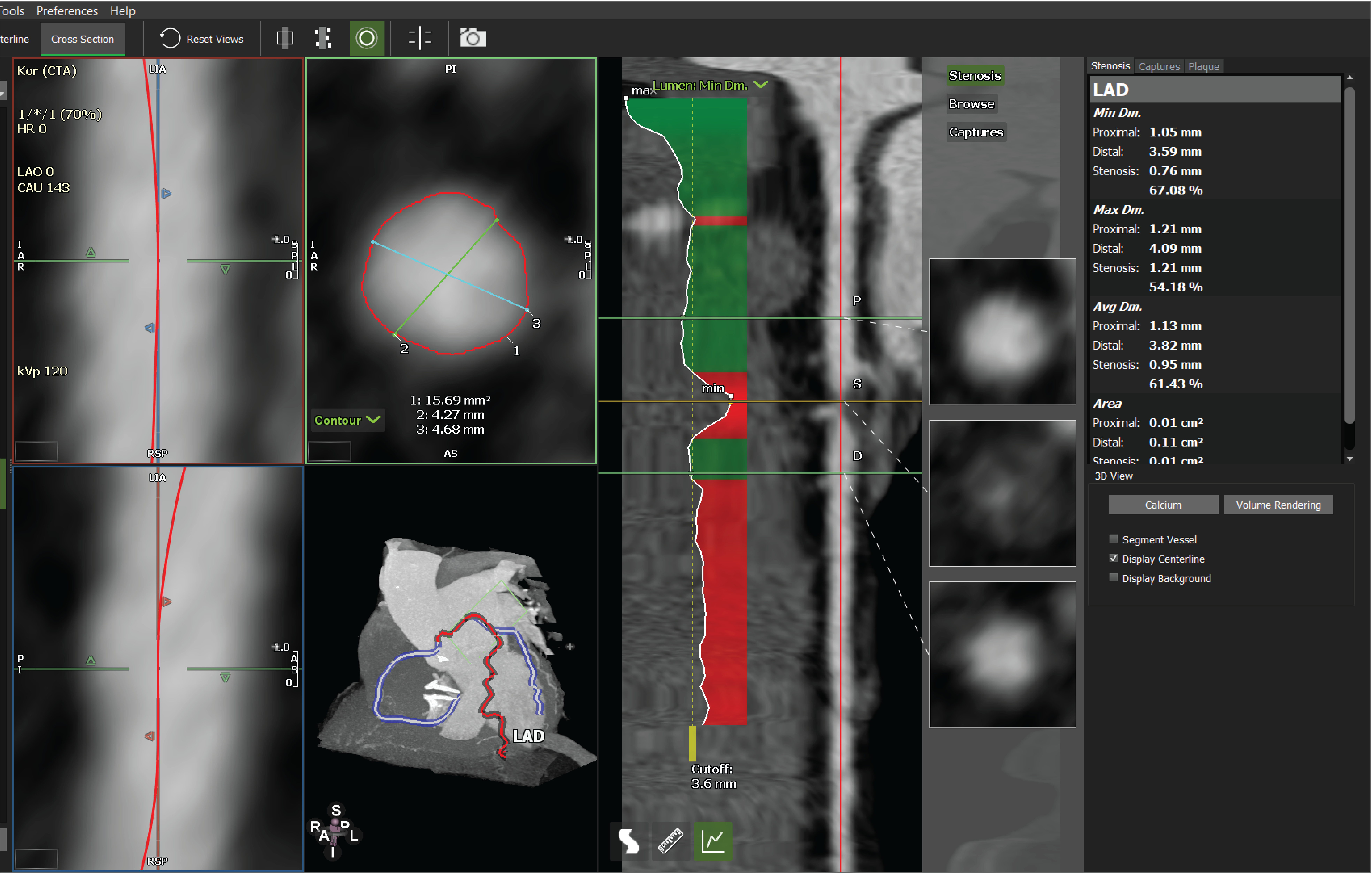 Siemens Healthineers Digital Marketplace