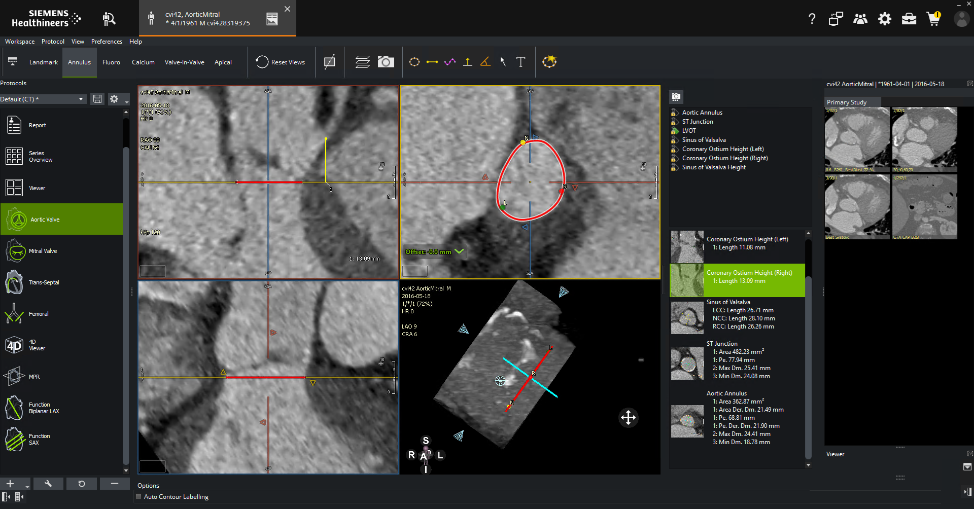 Siemens Healthineers Digital Marketplace