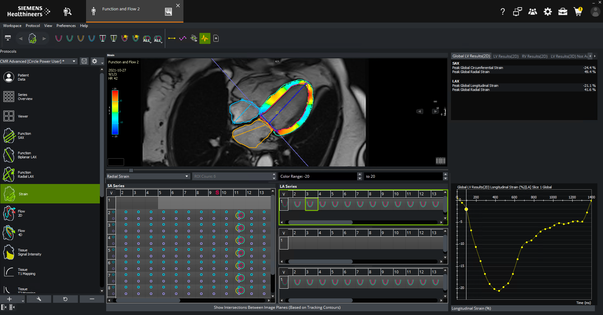 Siemens Healthineers Digital Marketplace