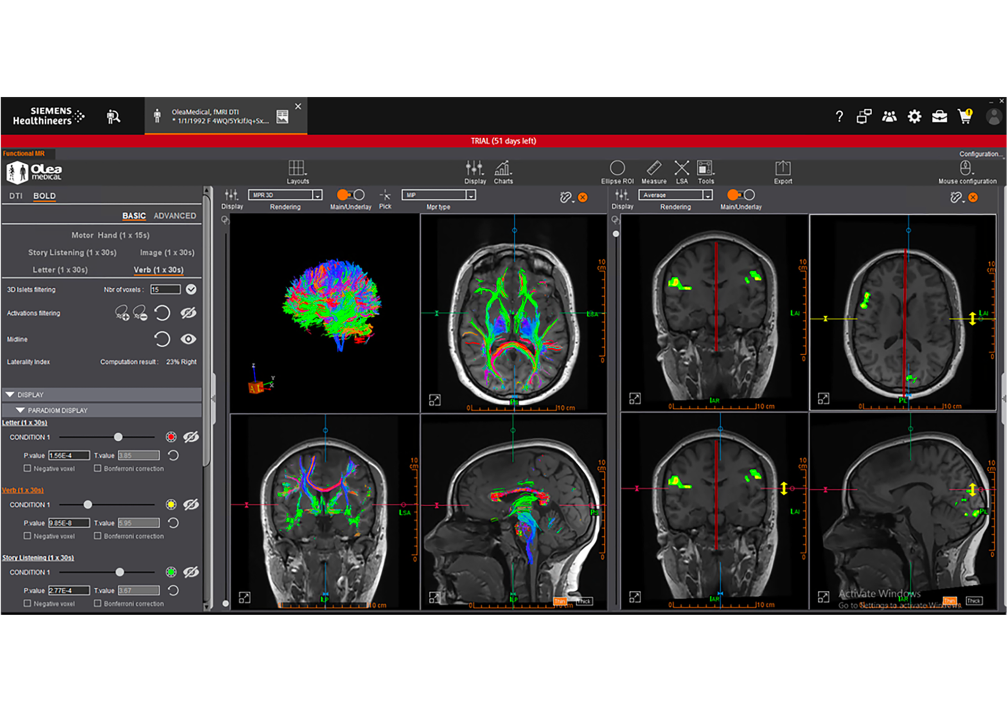 Siemens Healthineers Digital Marketplace