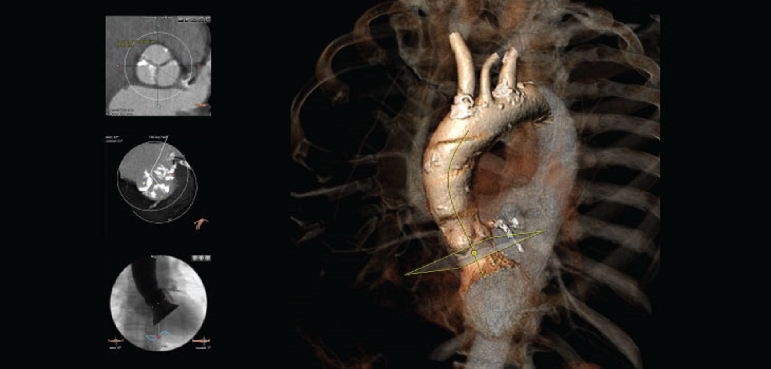 Siemens Healthineers Digital Marketplace