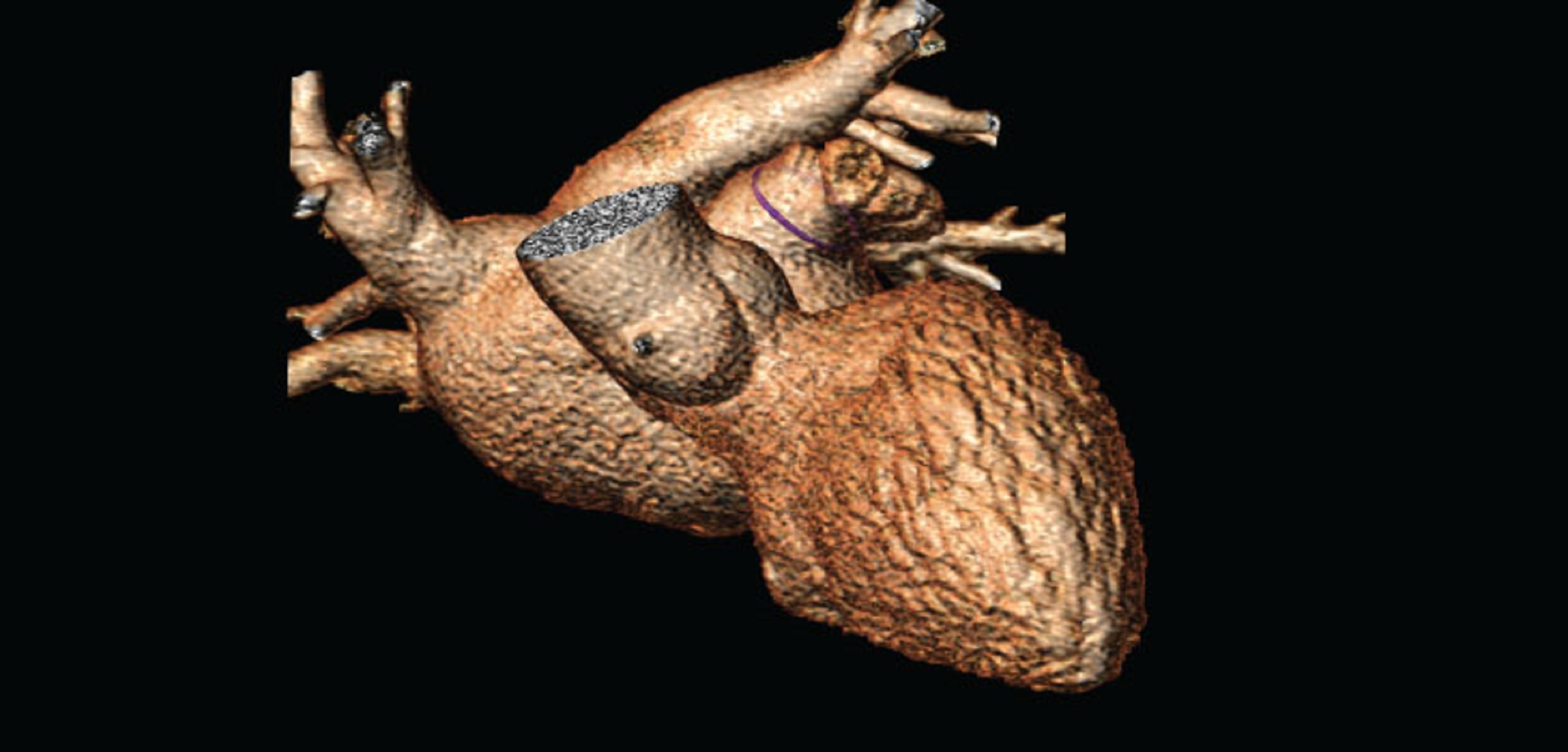 Siemens Healthineers Digital Marketplace